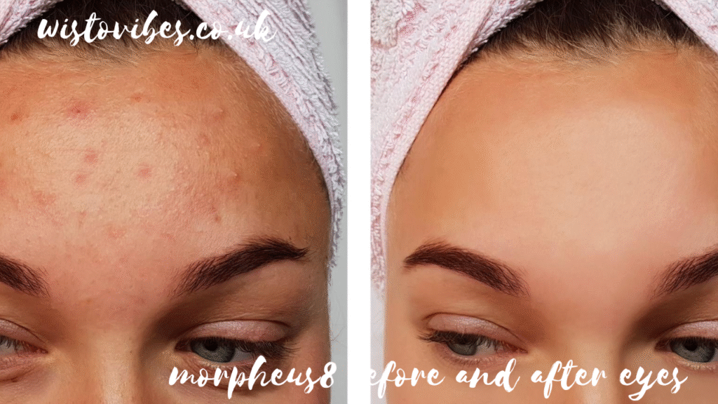 RWC Report in Safety, Importance, and Implementation: What Is RWC ...